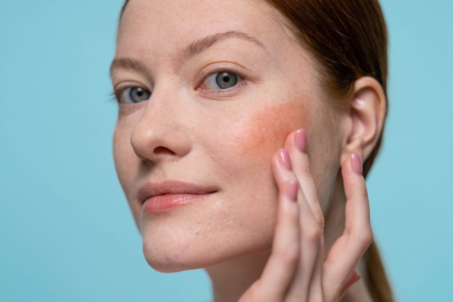 What's the Difference Between Eczema vs Rosacea - 2025 Comparison