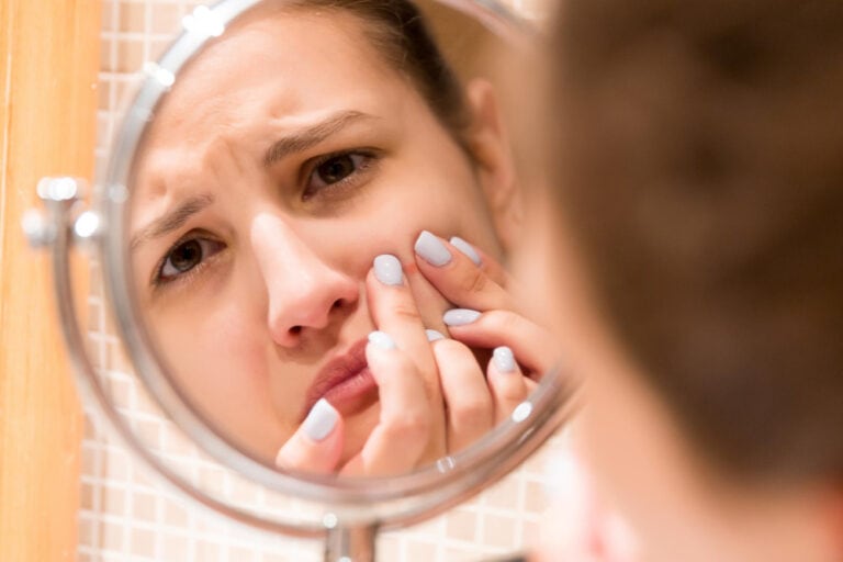 Simple Tips On How Do Acne Patches Work - 2023