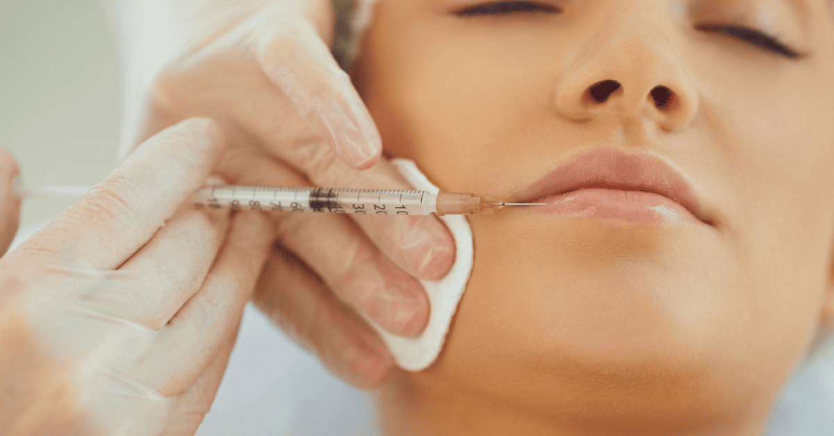 How Long Are Lips Swollen After Filler? - 2023 A Beginners Guide