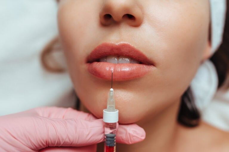 Complete Guide On How To Avoid Duck Lips With Lip Fillers - Beyond Beauty